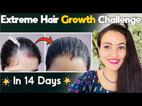 14 Days *Extreme Hair Growth* Challenge : Strongest Remedy to Grow Hair Faster, Longer & Thicker❤️
