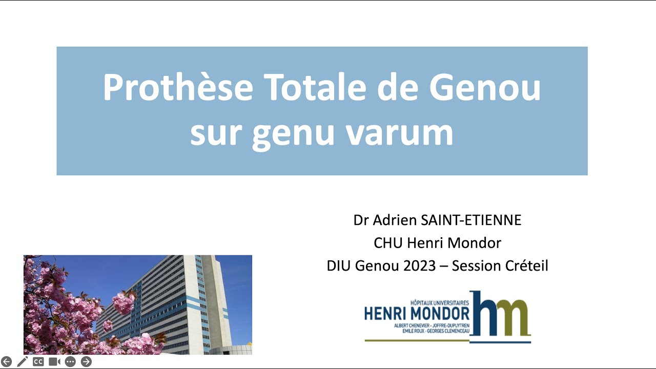 4 - PTG sur genu varum - YouTube