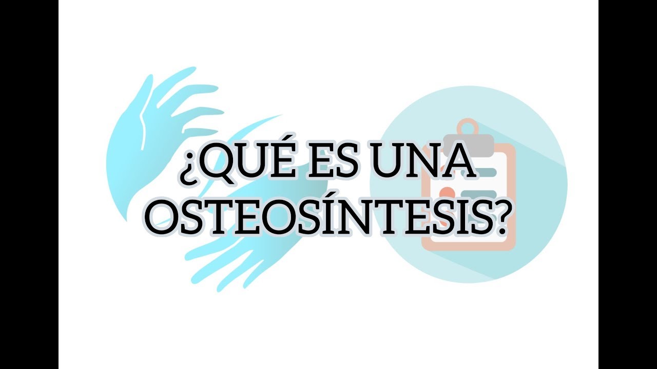 Qué es una Osteosintesis? - YouTube