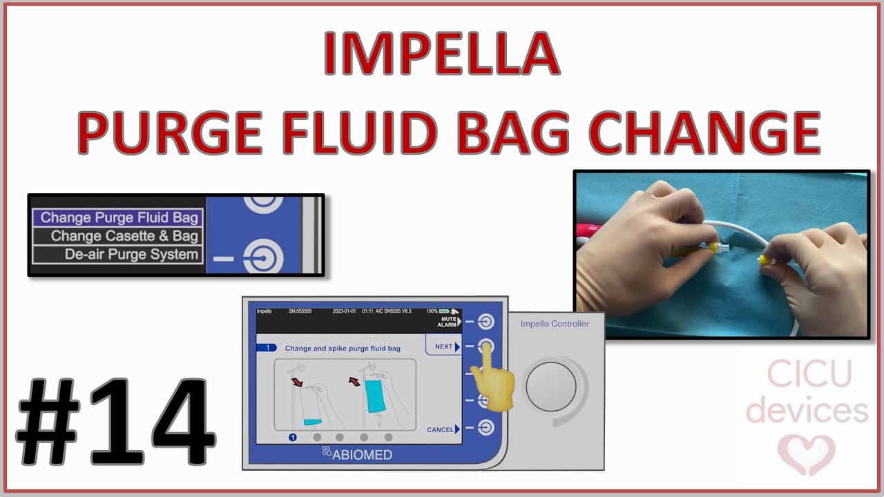 ⚙️ HOW TO CHANGE THE IMPELLA PURGE FLUID BAG, STEP BY STEP NURSING CARE ...