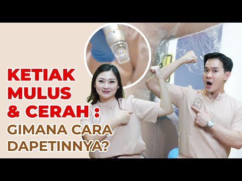 KETIAK MULUS & CERAH: GIMANA CARA DAPETINNYA?