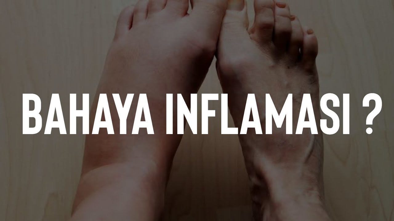 INFLAMASI ITU APA ? DAN BAGAIMANA CARA MENGURANGI INFLAMASI ? - YouTube