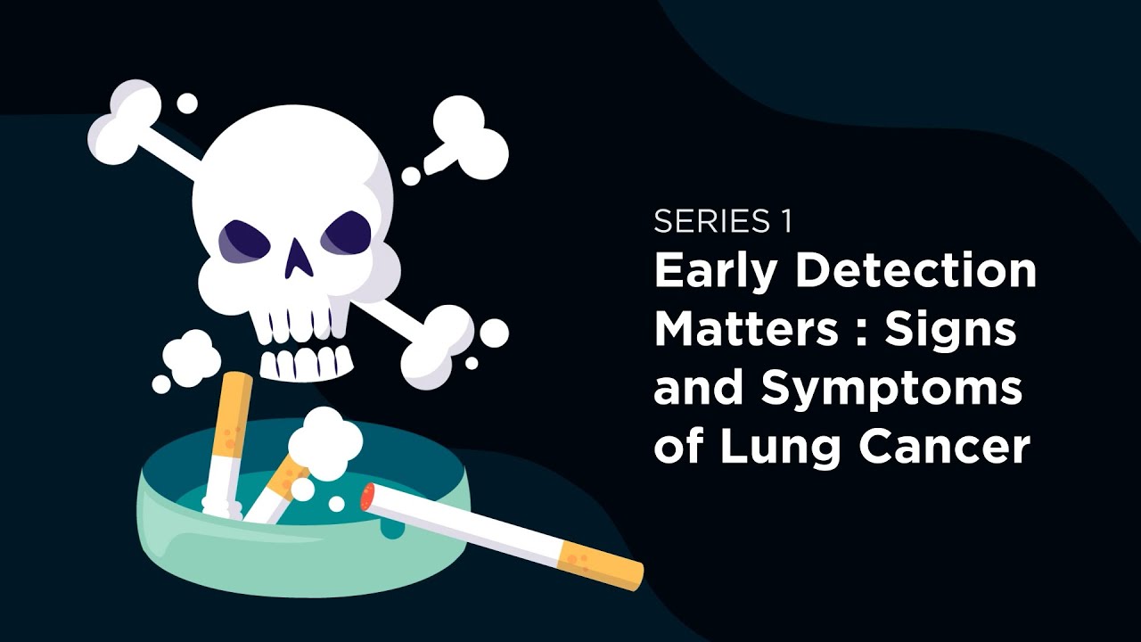 Early Detection Matters : Signs and Symptoms of Lung Cancer | Lung ...