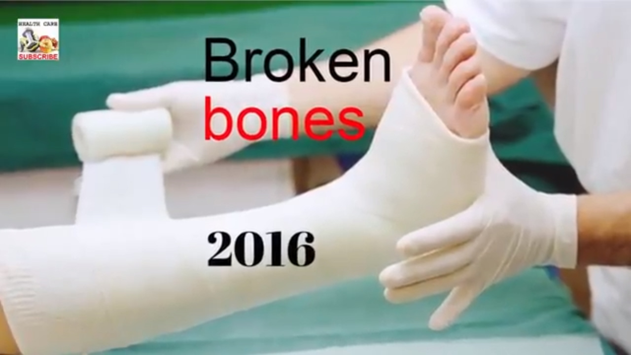 Broken bones 2016 - parkour fails 2016 parkour fails broken bones 2016 ...
