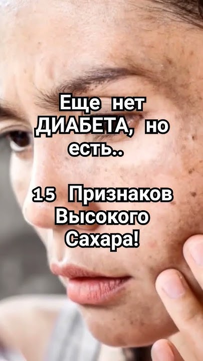 Вот так начинается ДИАБЕТ Первые ПРИЗНАКИ сахарного ДИАБЕТА диабет