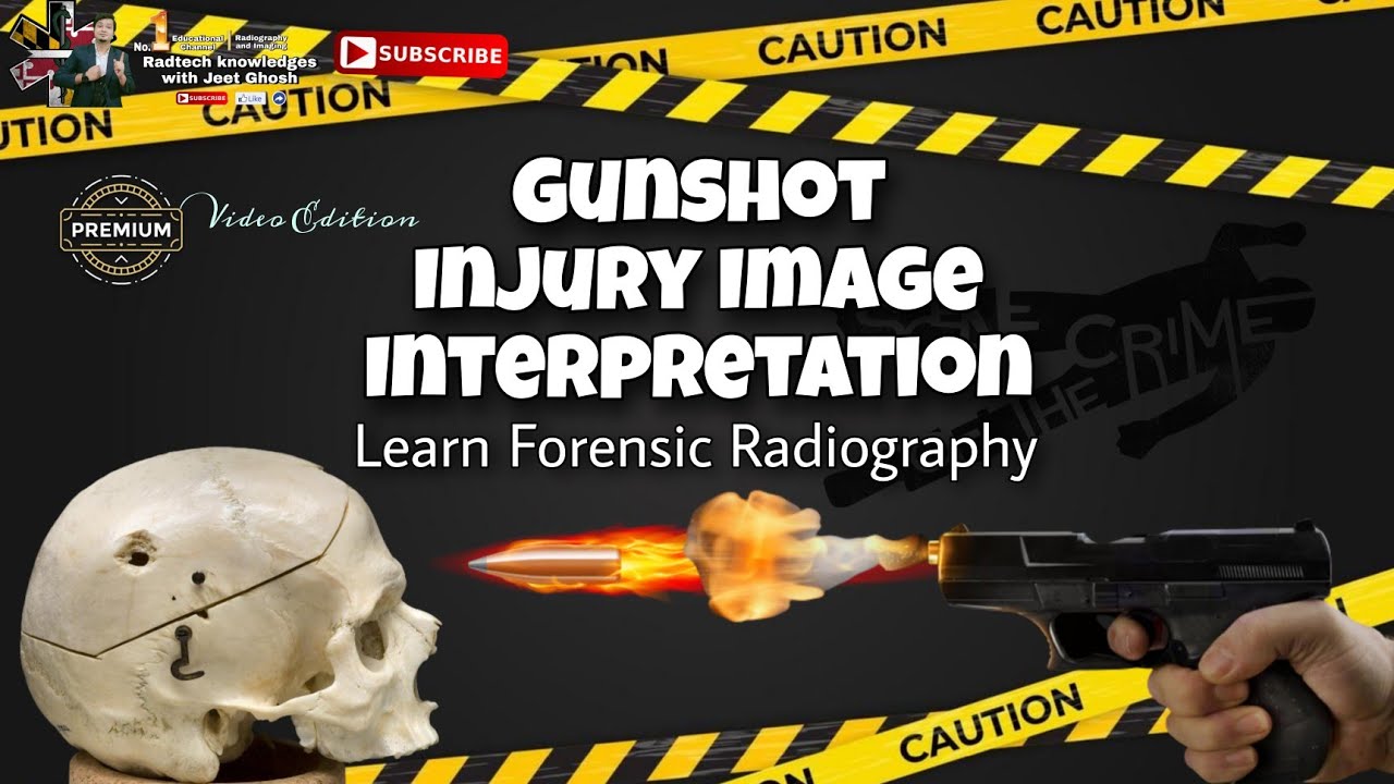 Gunshot injury Radiography |forensic Radiology|bullets|Guns |Radtech ...