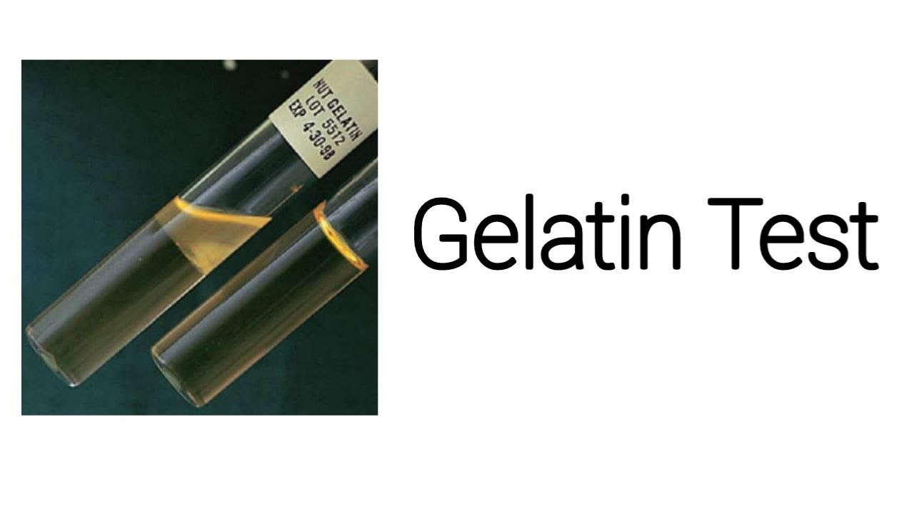 Gelatin Hydrolysis Test