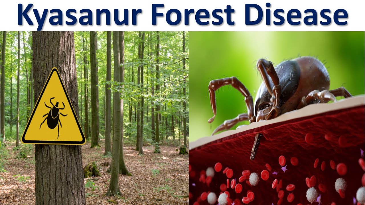 Kyasanur Forest Disease: Don't Get Ticked | Tick-Borne Viral Disease ...