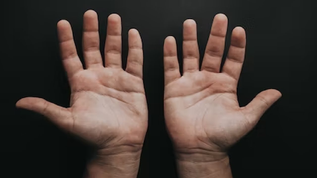 how to get rid of skinny hands - YouTube