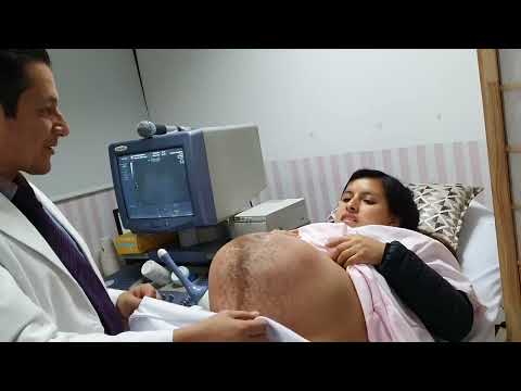 Una hermosa barrigita peluda