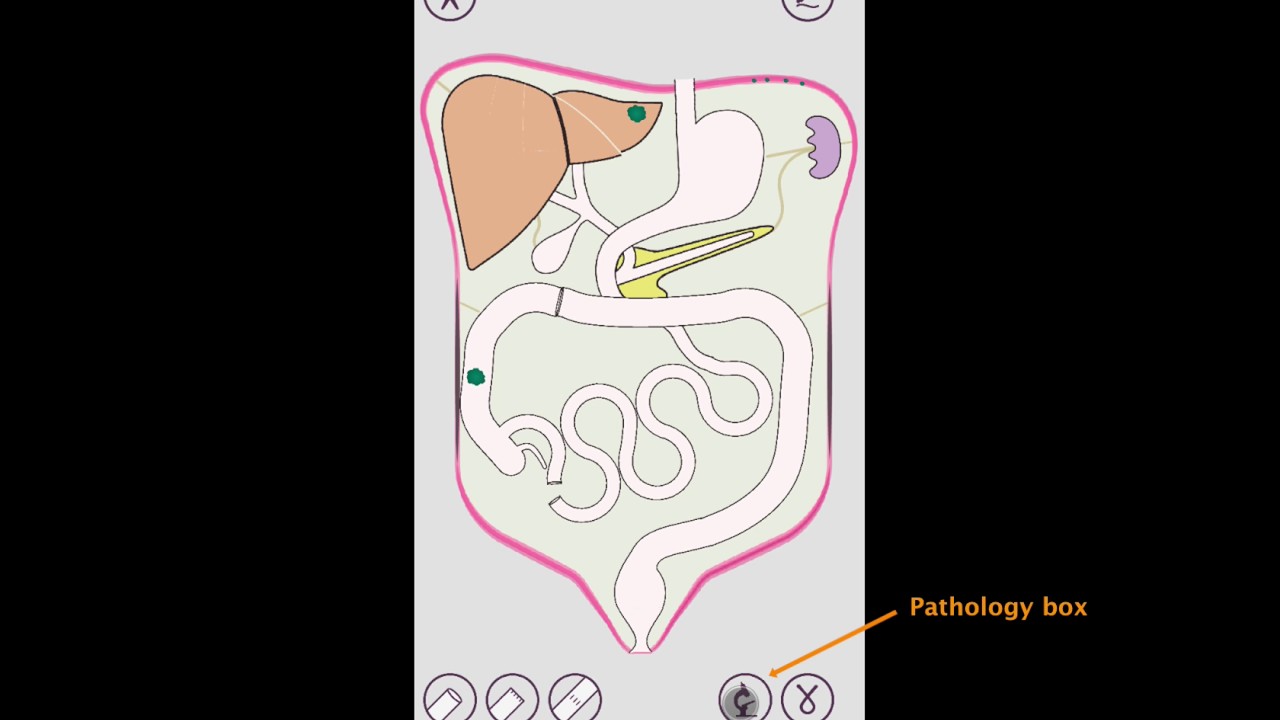 Sutures Tutorial. 2 Tools - YouTube