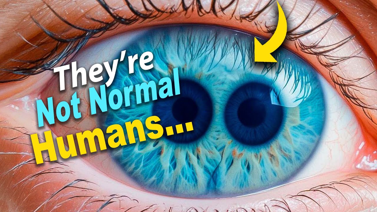 15 Real Diseases That Turn Humans Into Superhumans | Real-Life ...