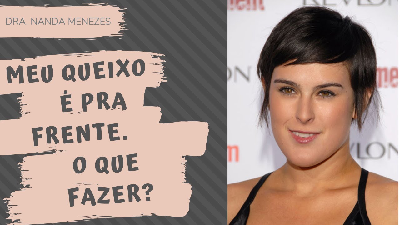 Meu queixo é pra frente, o que fazer? Classe 3| Dra. Nanda Menezes - YouTube