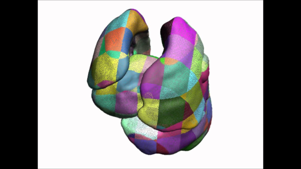 Organ tracking in 4D CT - YouTube