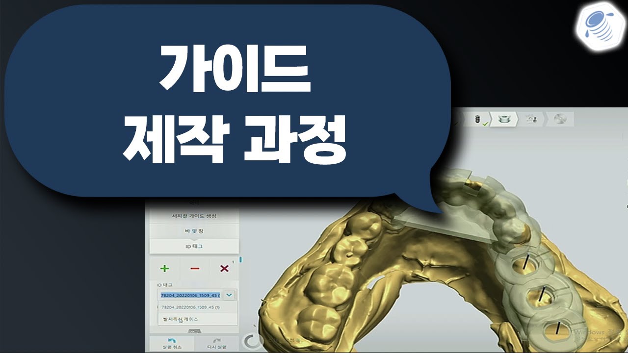 3SHAPE IMPLANT STUDIO YouTube 3shape-implant-studio-youtube
