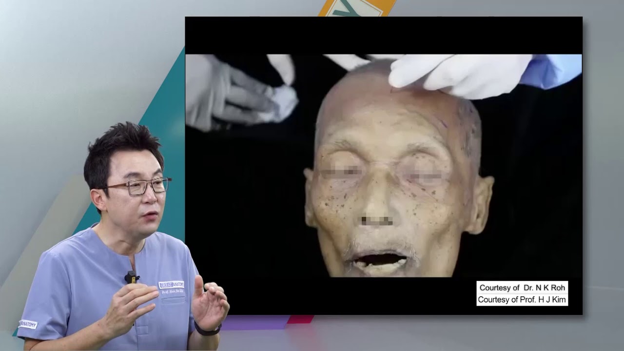 Chapter 2. Clinical anatomy of the glabella and sunken eye for filler ...