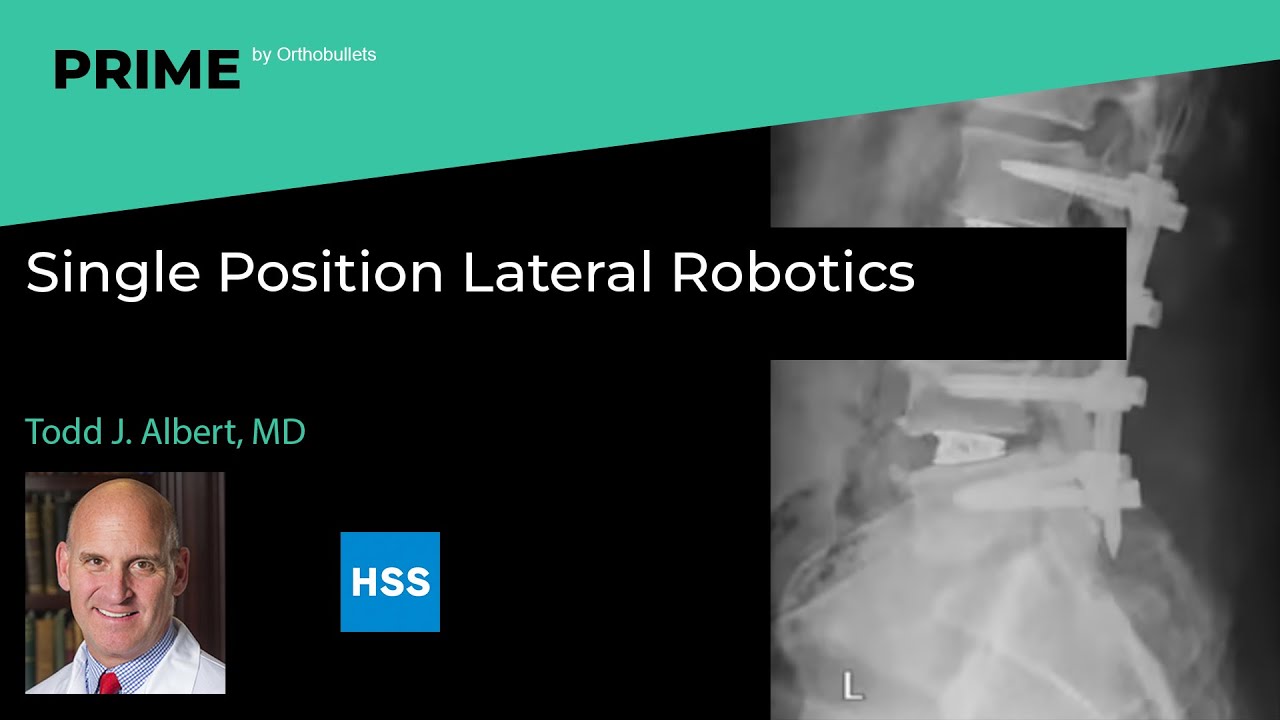 Single Position Lateral Robotics - Todd Albert, MD - YouTube