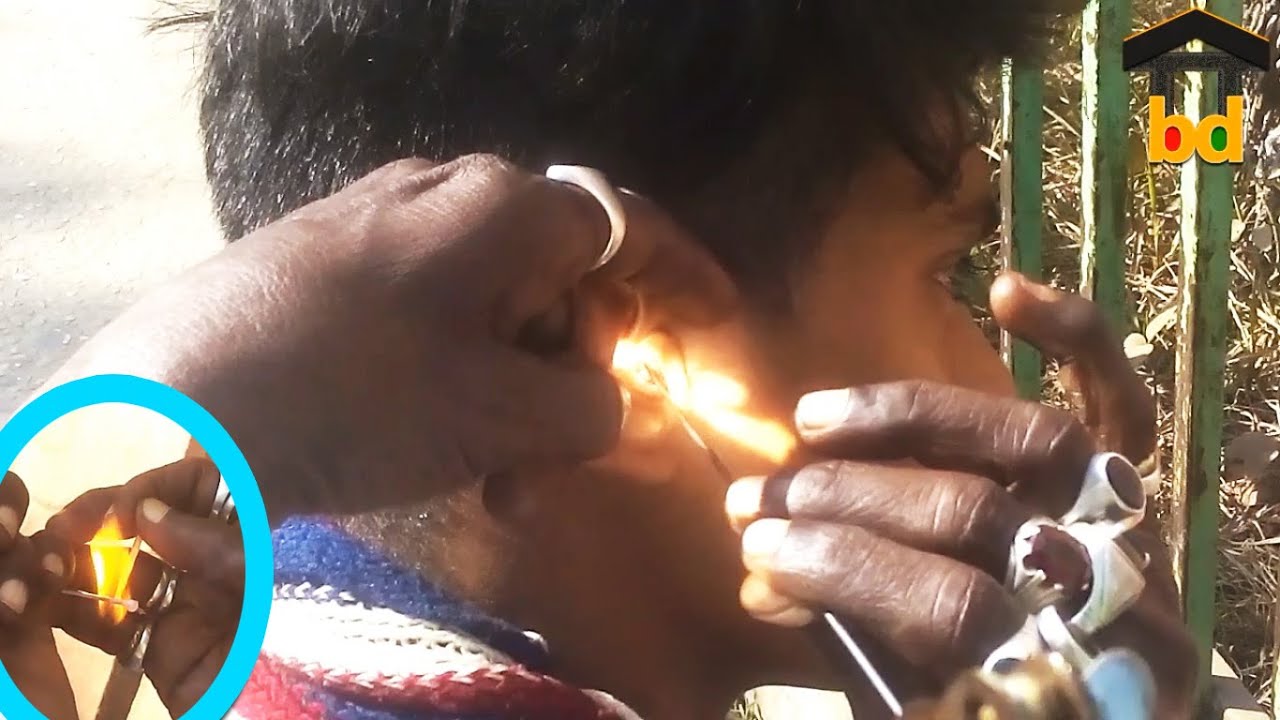 Roadside Ear Cleaning Using Exclusive Method II Ear Picking With Input ...