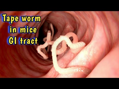 Tapeworm found in rat's intestine || ইঁদুরের পেটে ফিতা কৃমি - YouTube