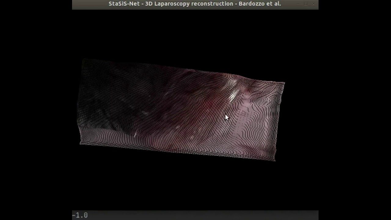 Supplementary materials of StaSiS-Net - YouTube