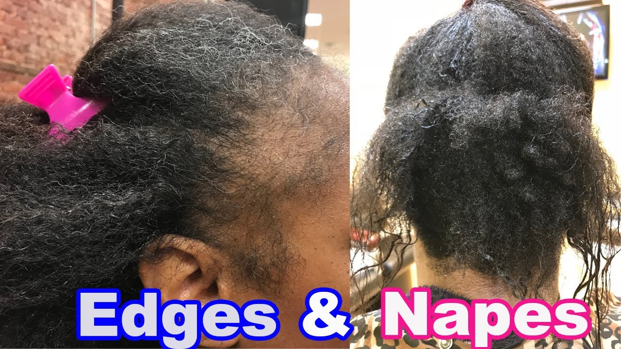 How to Finally Grow Your Edges, Nape and Crown! FREE Class - YouTube