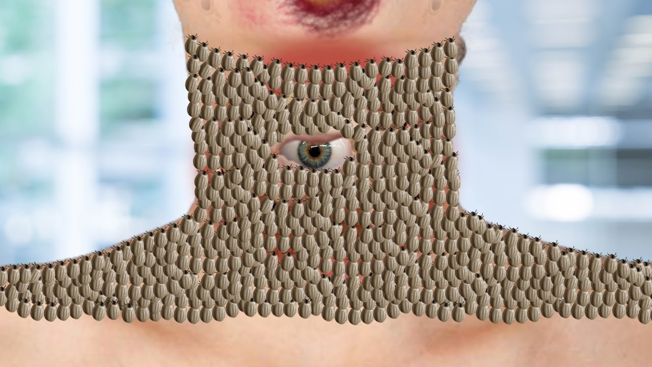 ASMR Dog ticks parasitic on the neck & Remove giant maggots ...