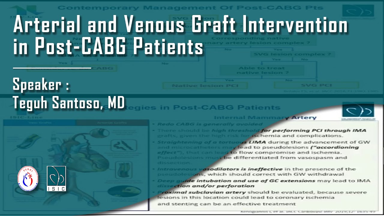 Arterial and Venous Graft Intervention in Post CABG Patients - YouTube