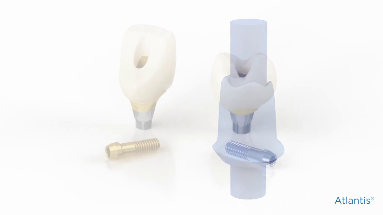 Atlantis CustomBase Solutions - YouTube