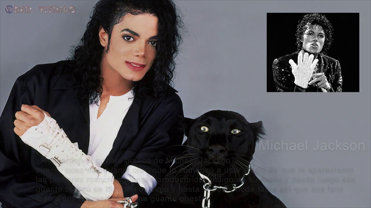 ARTISTAS Y CELEBRIDADES FAMOSOS CON VITILIGO │ FAMOUS WITH VITILIGO ...