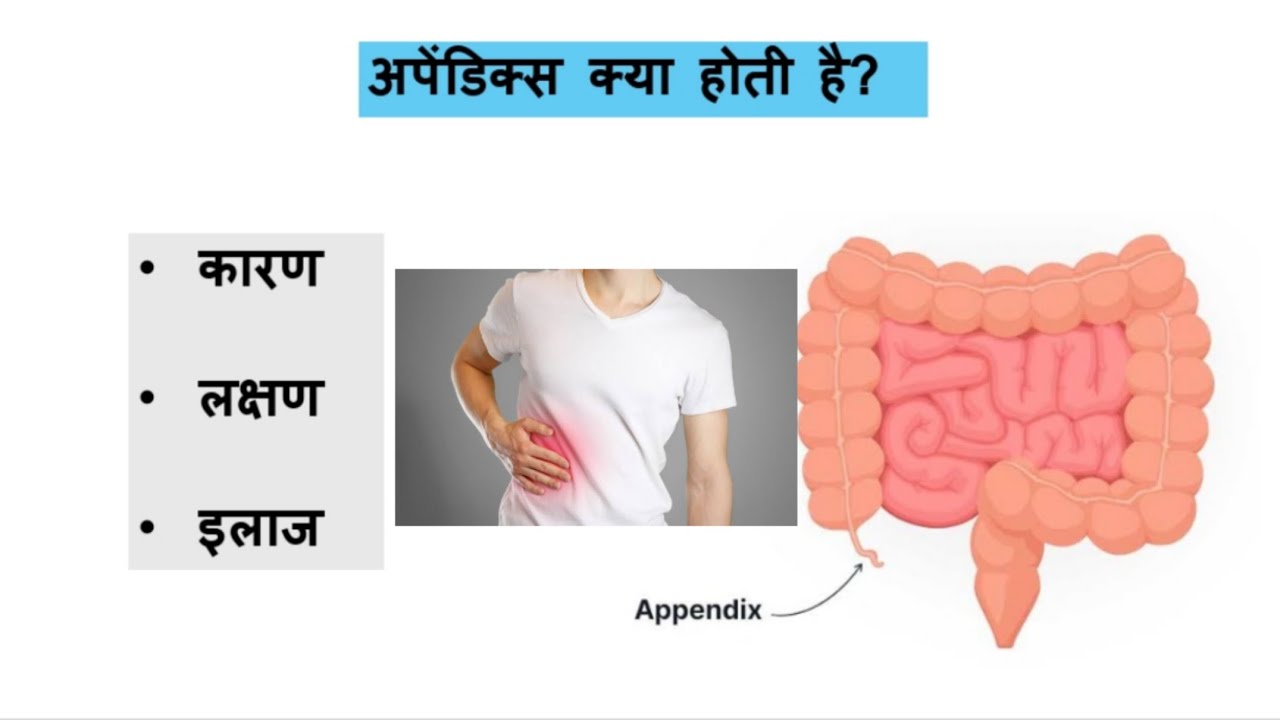 अपेंडिक्स क्या होती है? कारण, लक्षण और इलाज | Appendix Causes, Symptoms ...