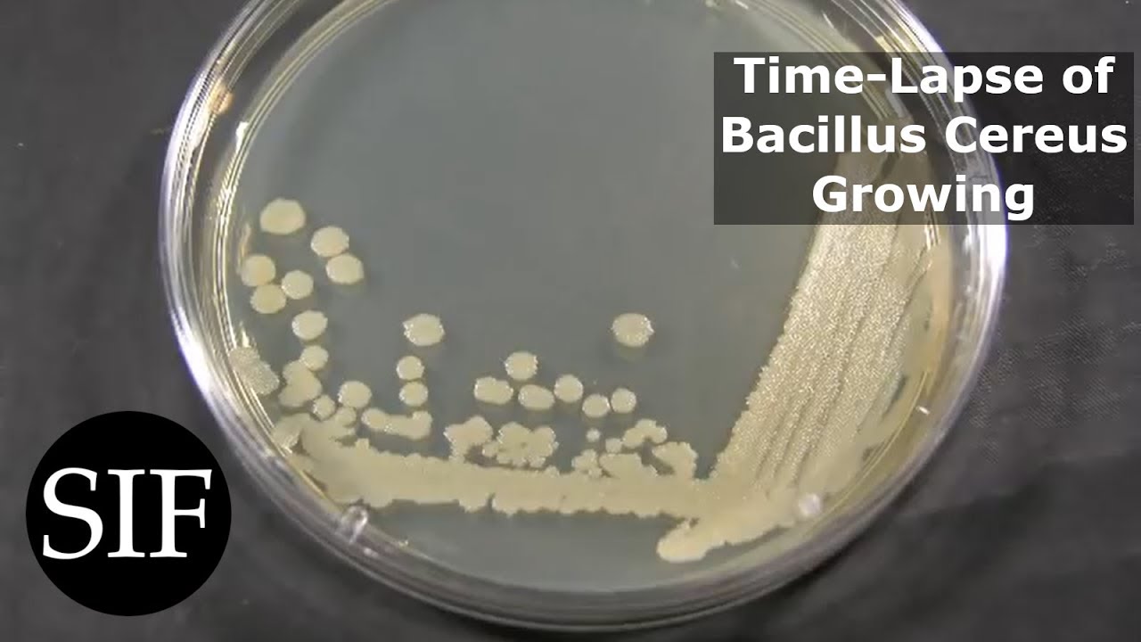 Time Lapse of Bacteria - Bacillus Cereus - Growing in Petri Dish - YouTube