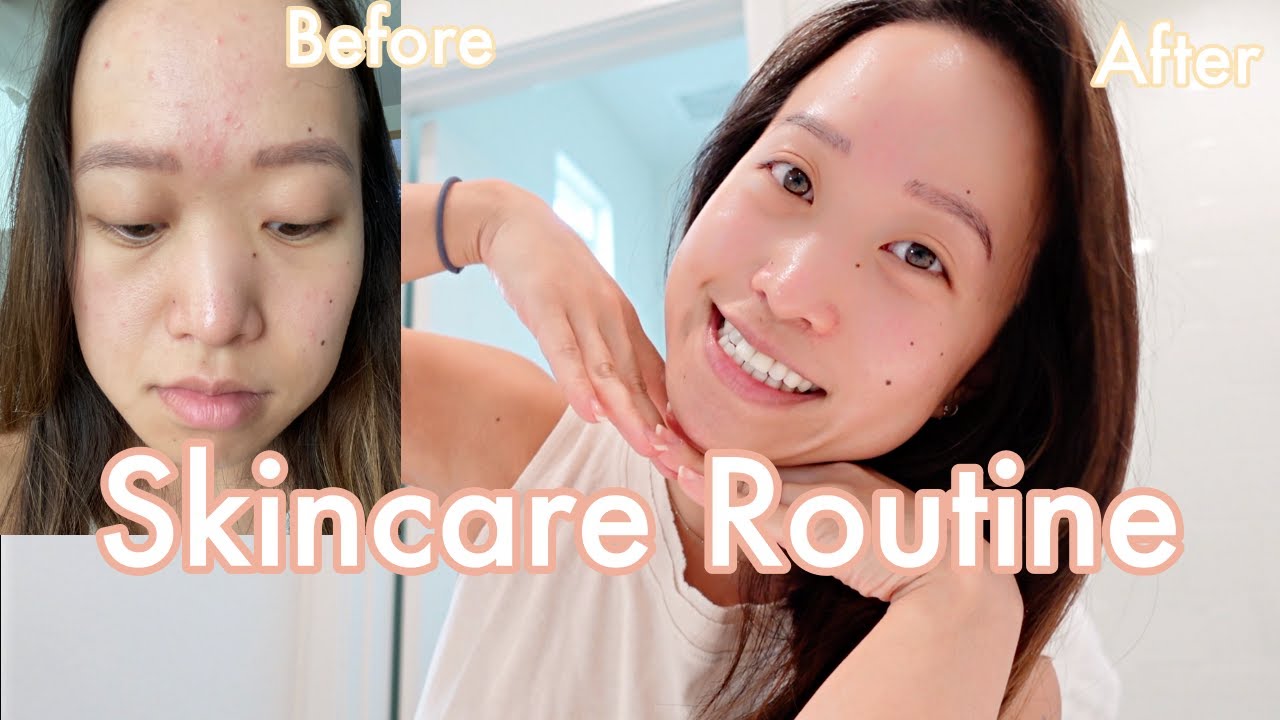 Minimalist Skincare Routine Oily Skin Youtube
