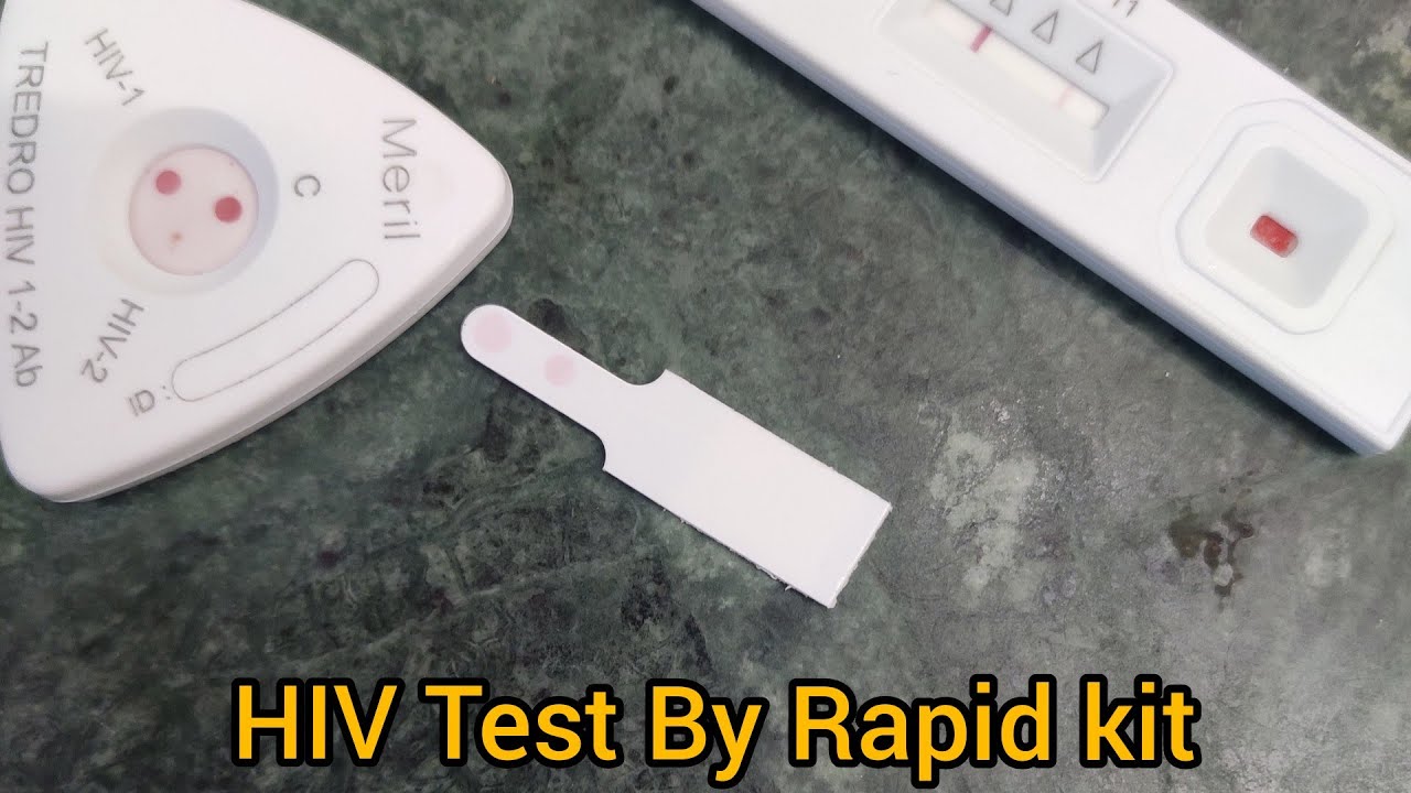 HIV Test | Hiv Test Procedure by Rapid kit | HIV AIDS | - YouTube
