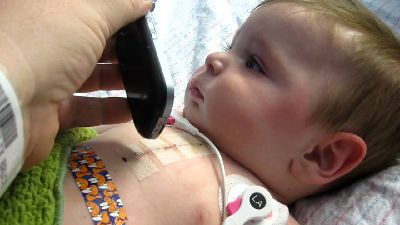 Brother talks to Felix - after Open Heart Surgery - YouTube