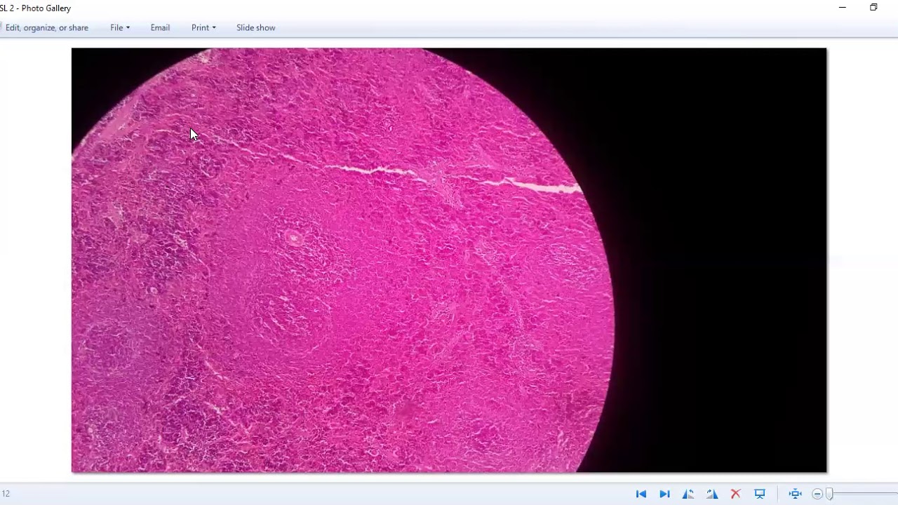 Histologi sistem limfoid - YouTube