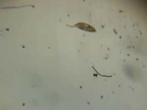 Lake Water Microorganism - YouTube