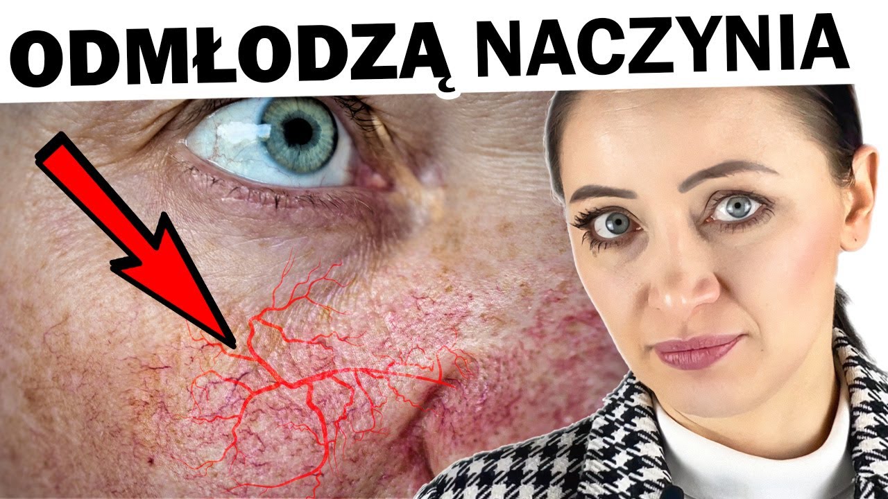 Słabe i kruche naczynia krwionośne? Brakuje Ci tych składników ...