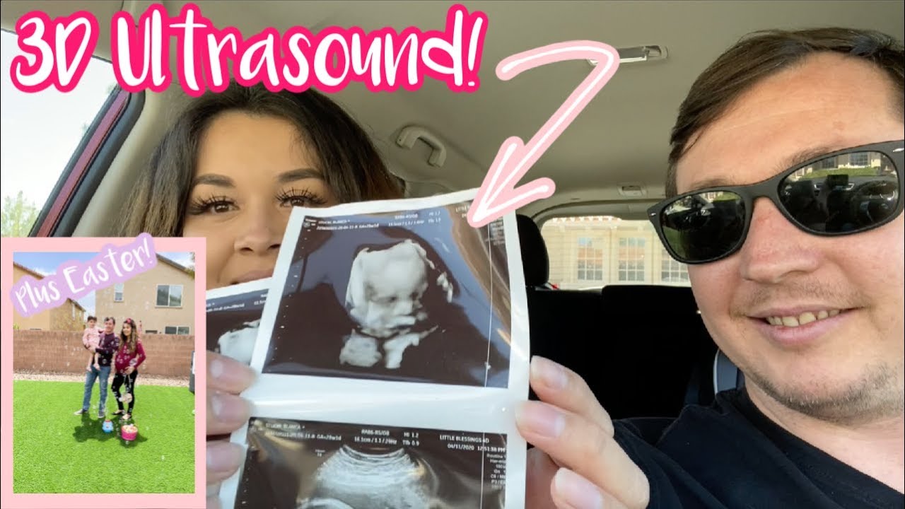 3D ULTRASOUND 28 WEEKS PREGNANT - YouTube