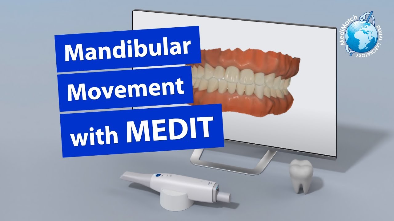 Mandibular Movement with Medit - YouTube