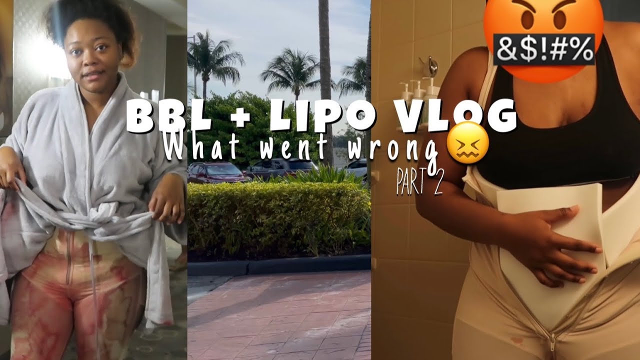 SURGERY DAY | BBL + LIPO VLOG | @SpectrumAesthetics | Raw + Uncut | The ...