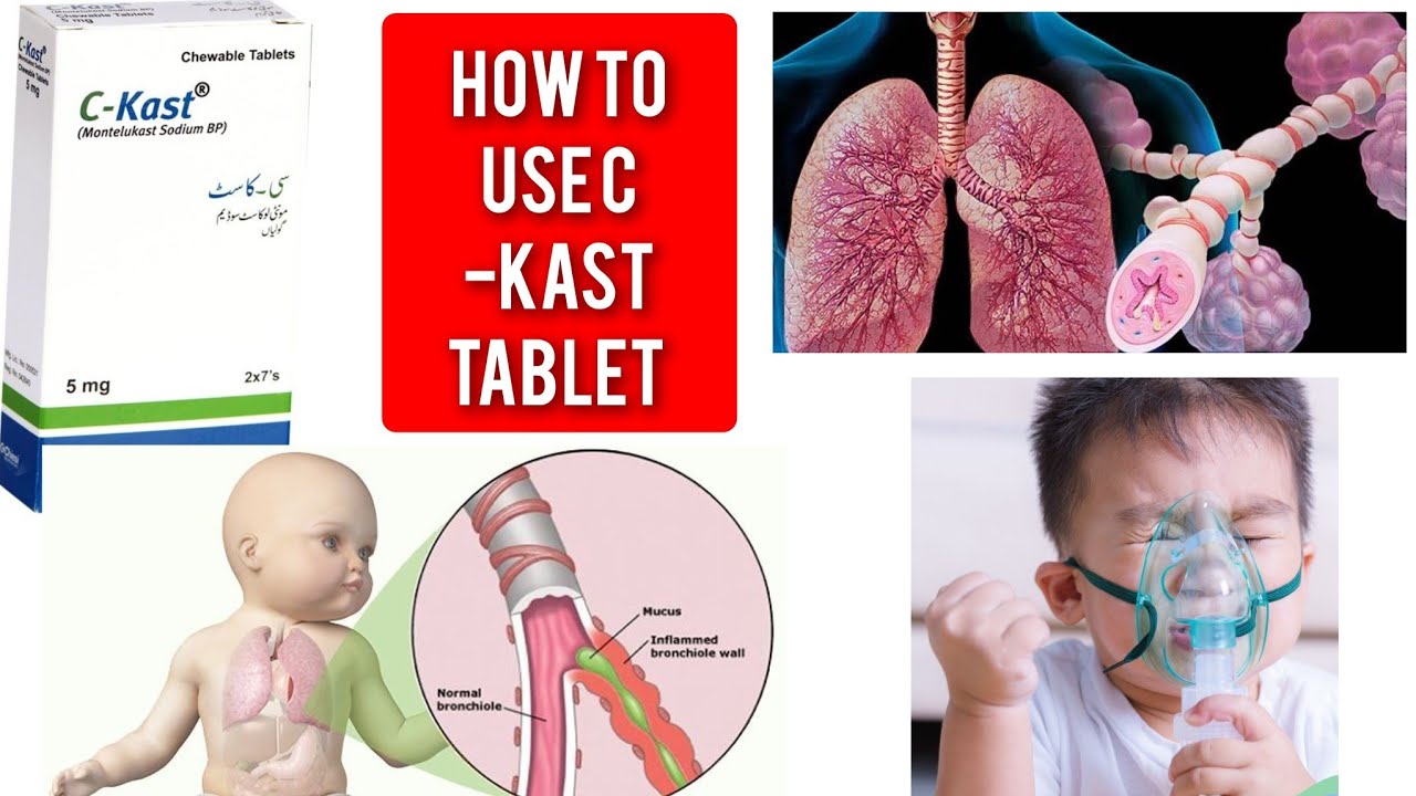 How to use C-Kast tablet/C-Kast tablet benefits and side effects - YouTube