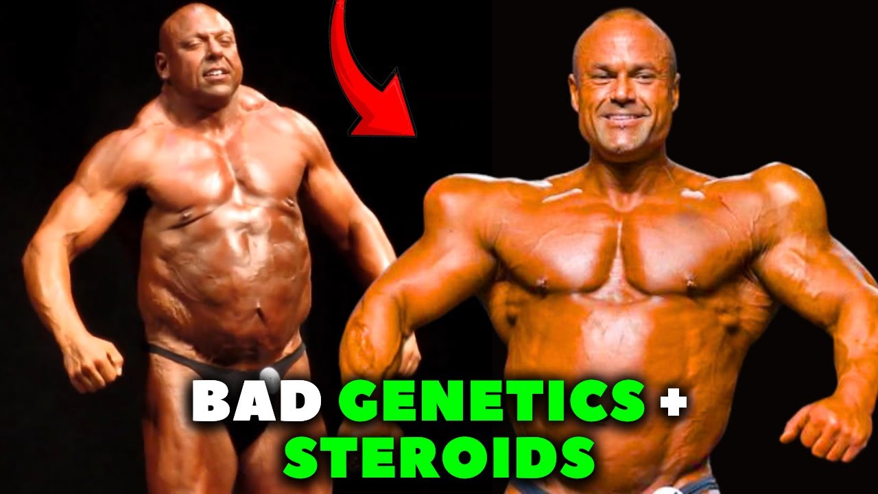 When Steroids Can’t Save You from Bad Genetics in Bodybuilding - YouTube