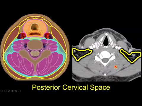 Head Neck Spaces Anatomy and Pathology Part1 ASHNR20 Session11 Core ...