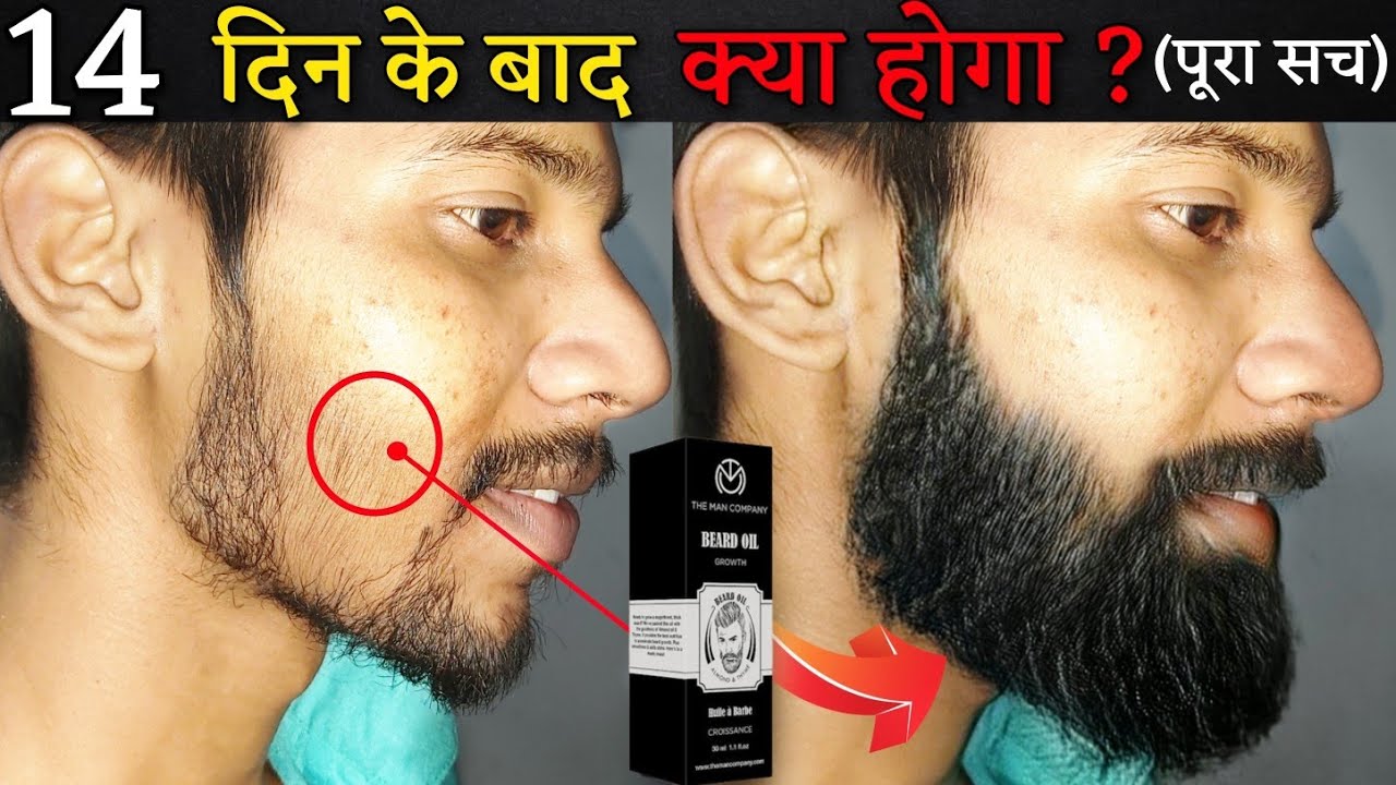 The Man Company Beard Growth Oil After 14 Days Review | How to Use ...