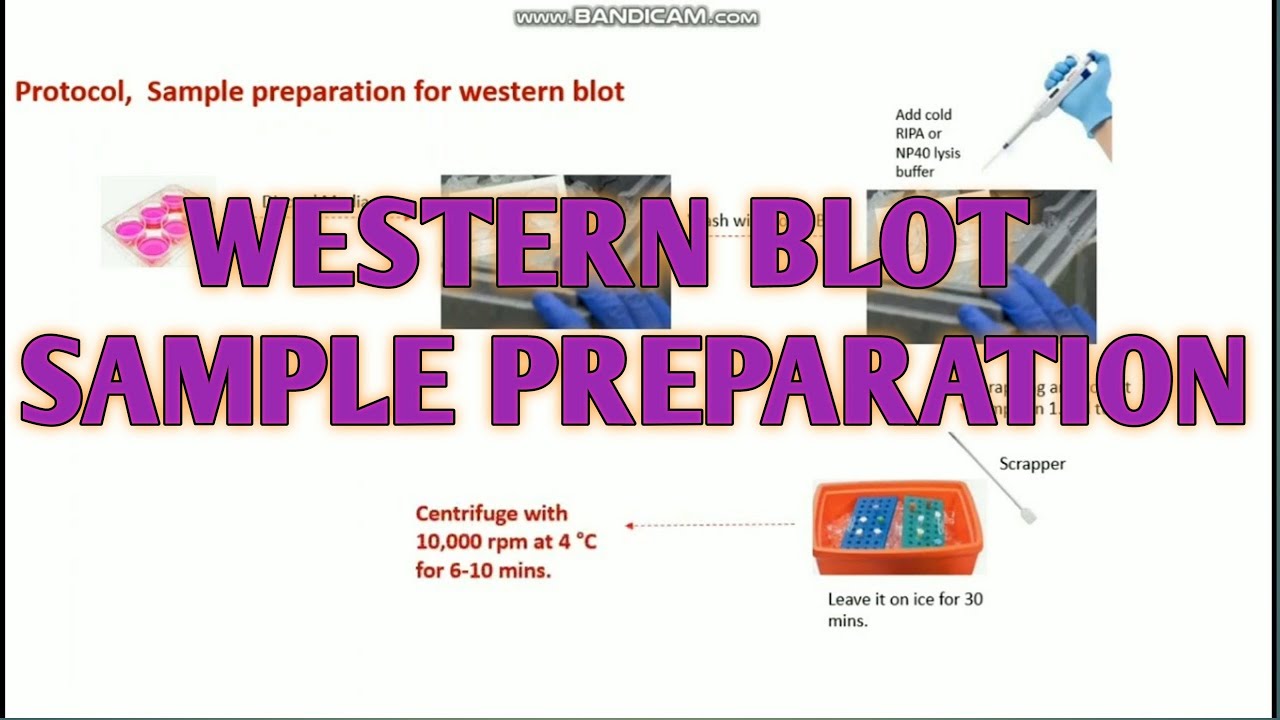 western blot sample preparation protocol ll Sample preparation for SDS ...
