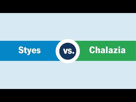 Can Styes Cause Swelling Under The Eye