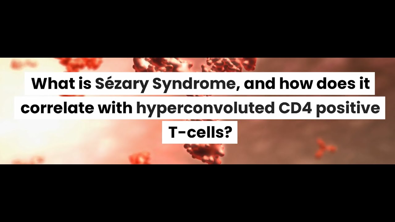 What is Sézary Syndrome, and how does it correlate with hyperconvoluted ...