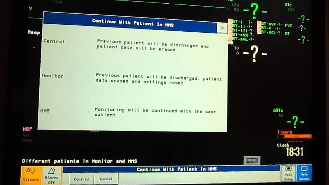 Philips MP70 Different patients in monitor and MMS - YouTube