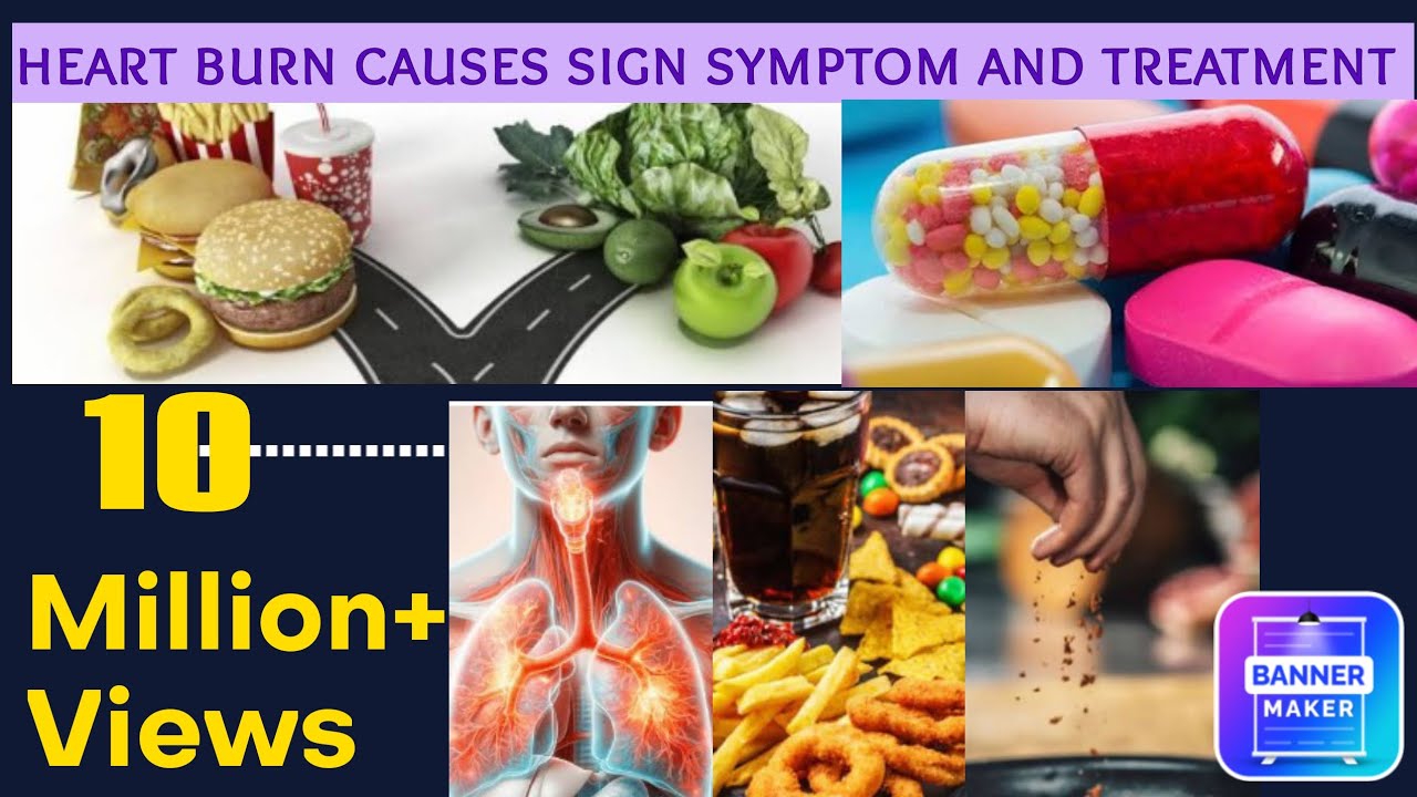 heart burn causes sign symptom and treatment ##health ### ...