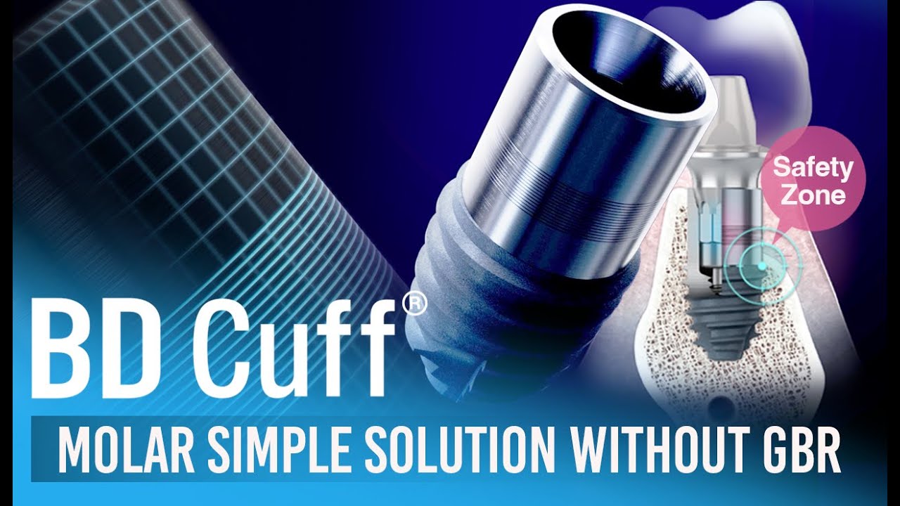 Introducing BD Cuff® Implant - YouTube